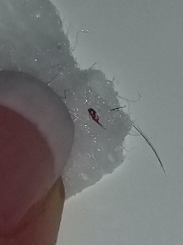 Nits In Hair Under Microscope at Ronald Wray blog